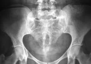 Pelvic Pain - The Pain Center