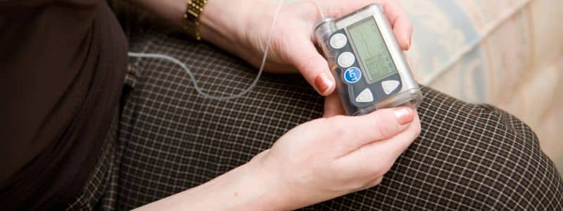 Common Questions About Medtronic - The Pain Center