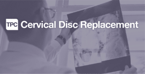 Cervical Disc Replacement - The Pain Center